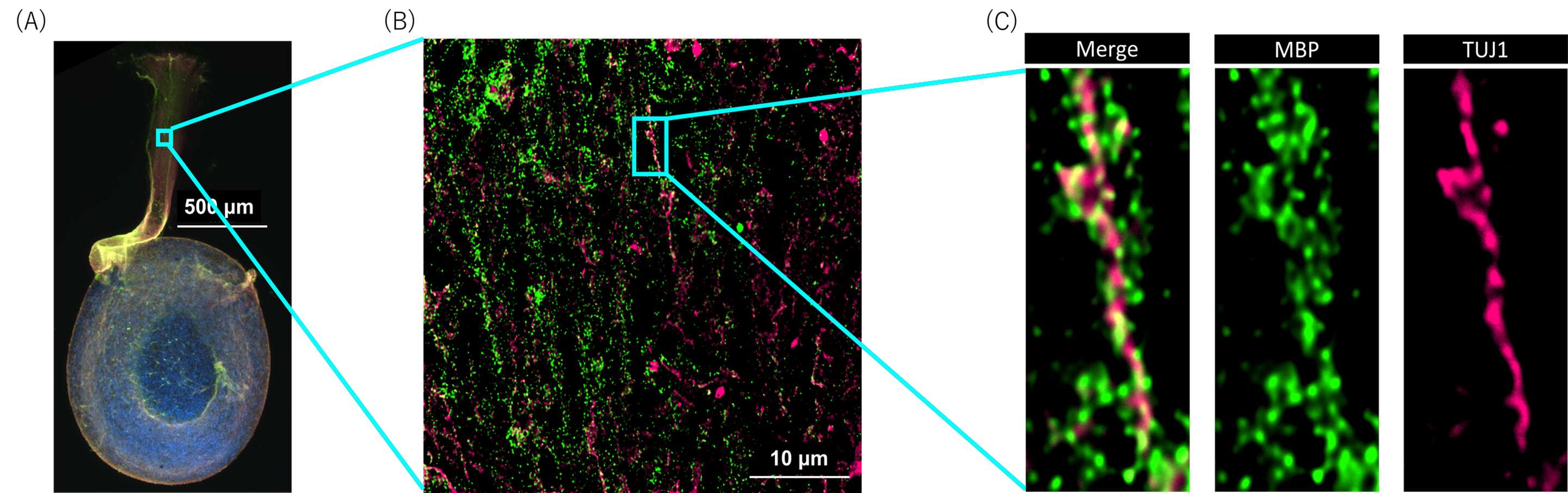3D super-resolution imaging of myelin structure in human iPSC-derived myelin sheath organoids by ...