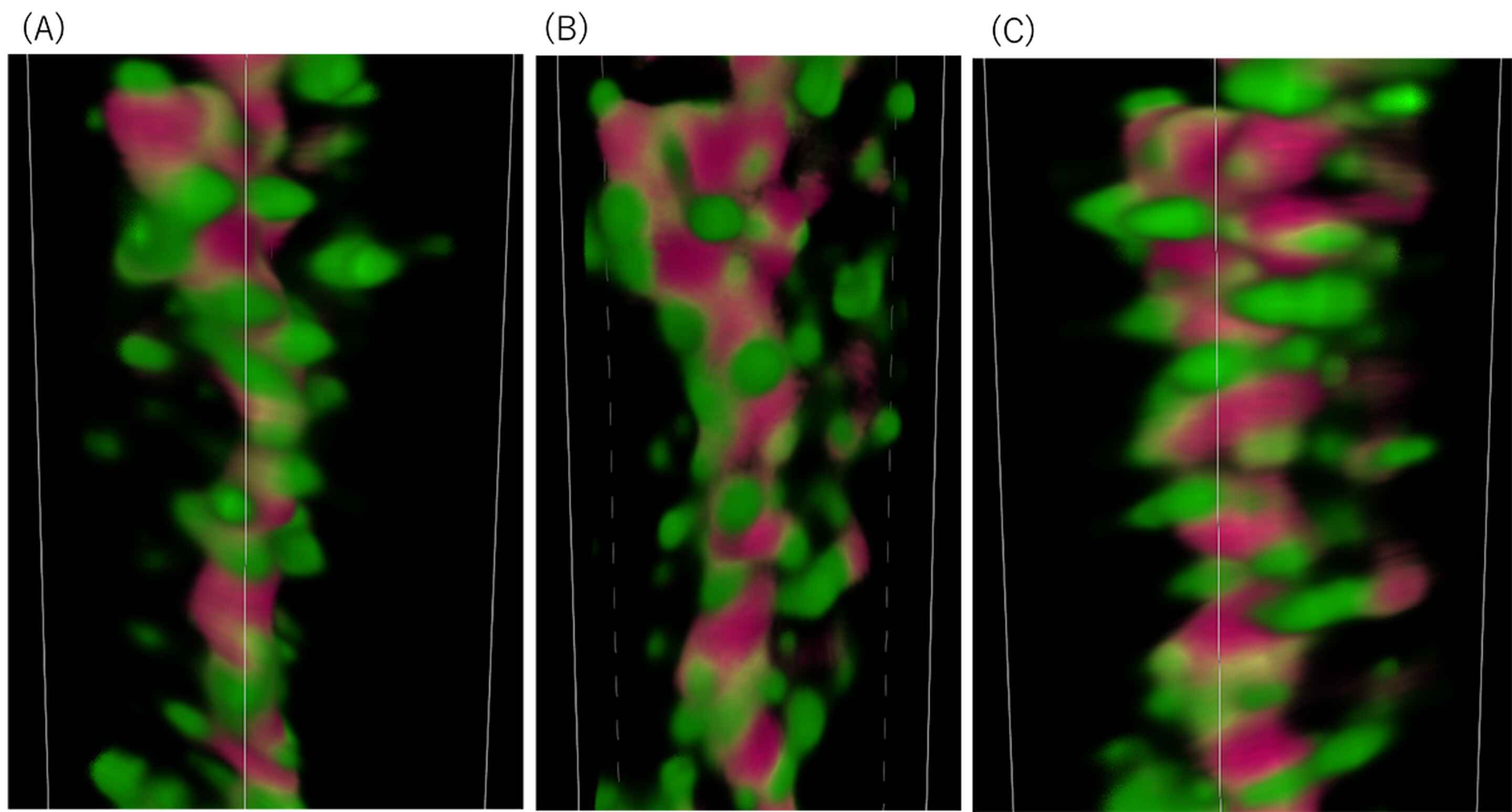 3D super-resolution imaging of myelin structure in human iPSC-derived myelin sheath organoids by ...