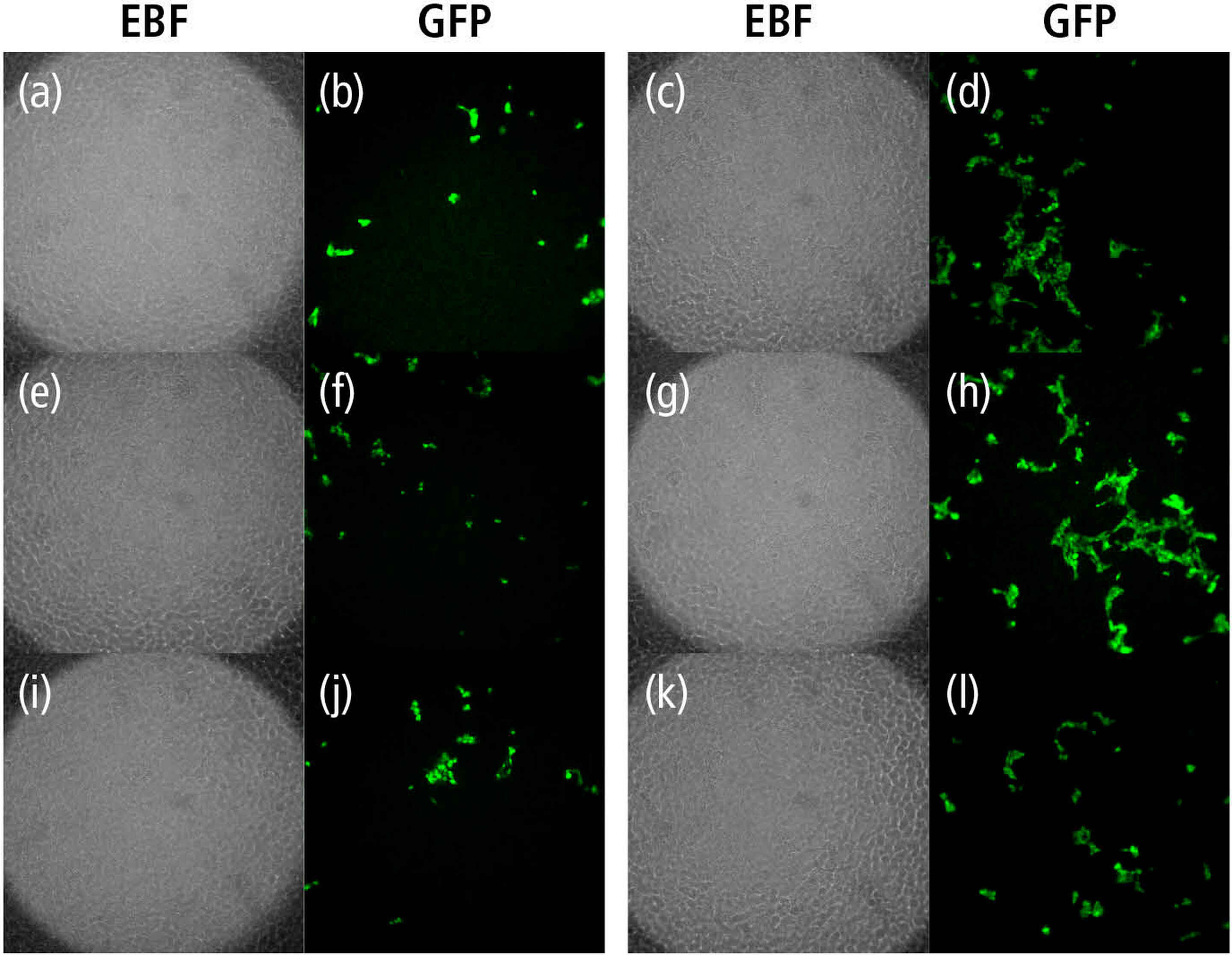 Visualization of cells cultured on cell-culture inserts and ...