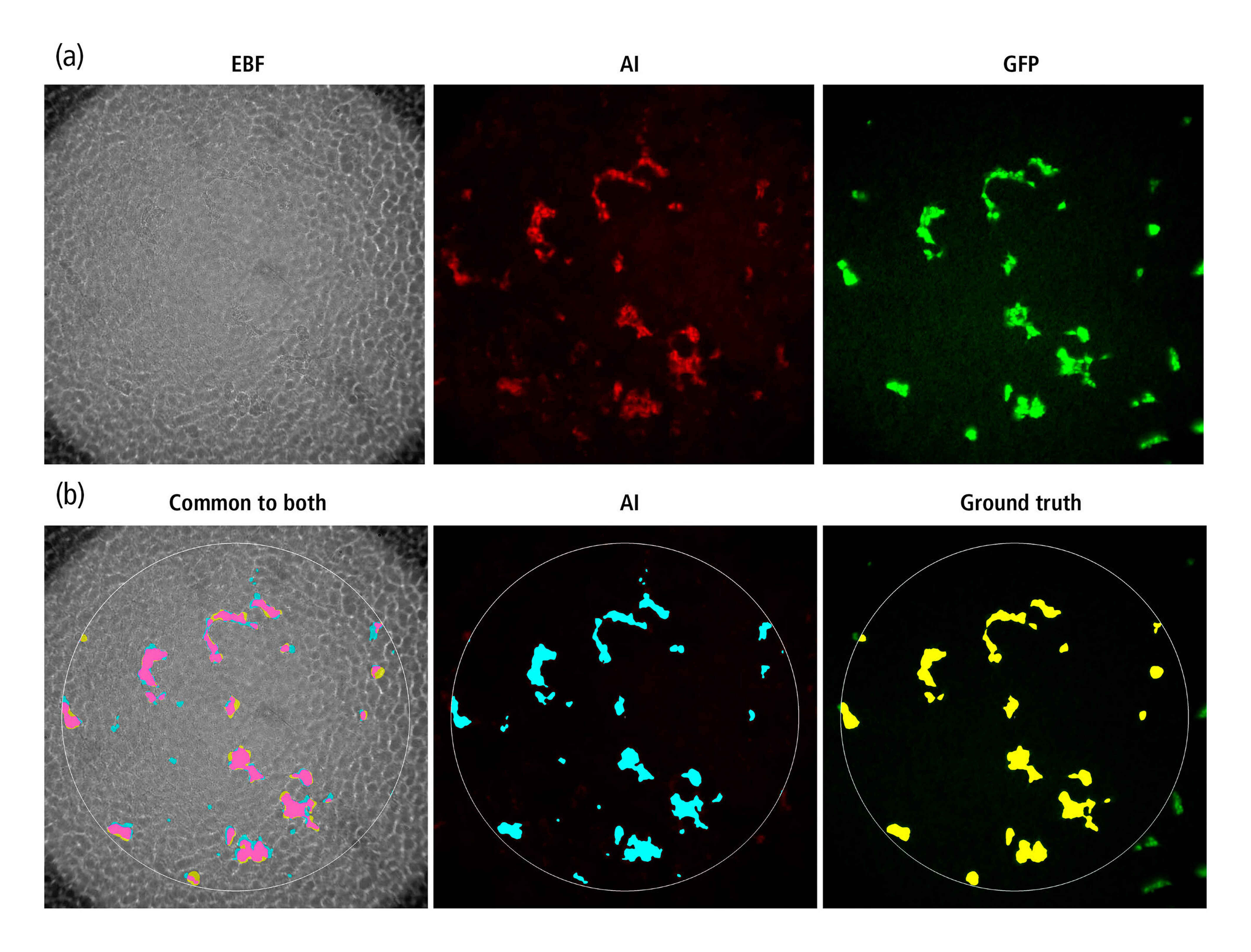 Visualization of cells cultured on cell-culture inserts and ...