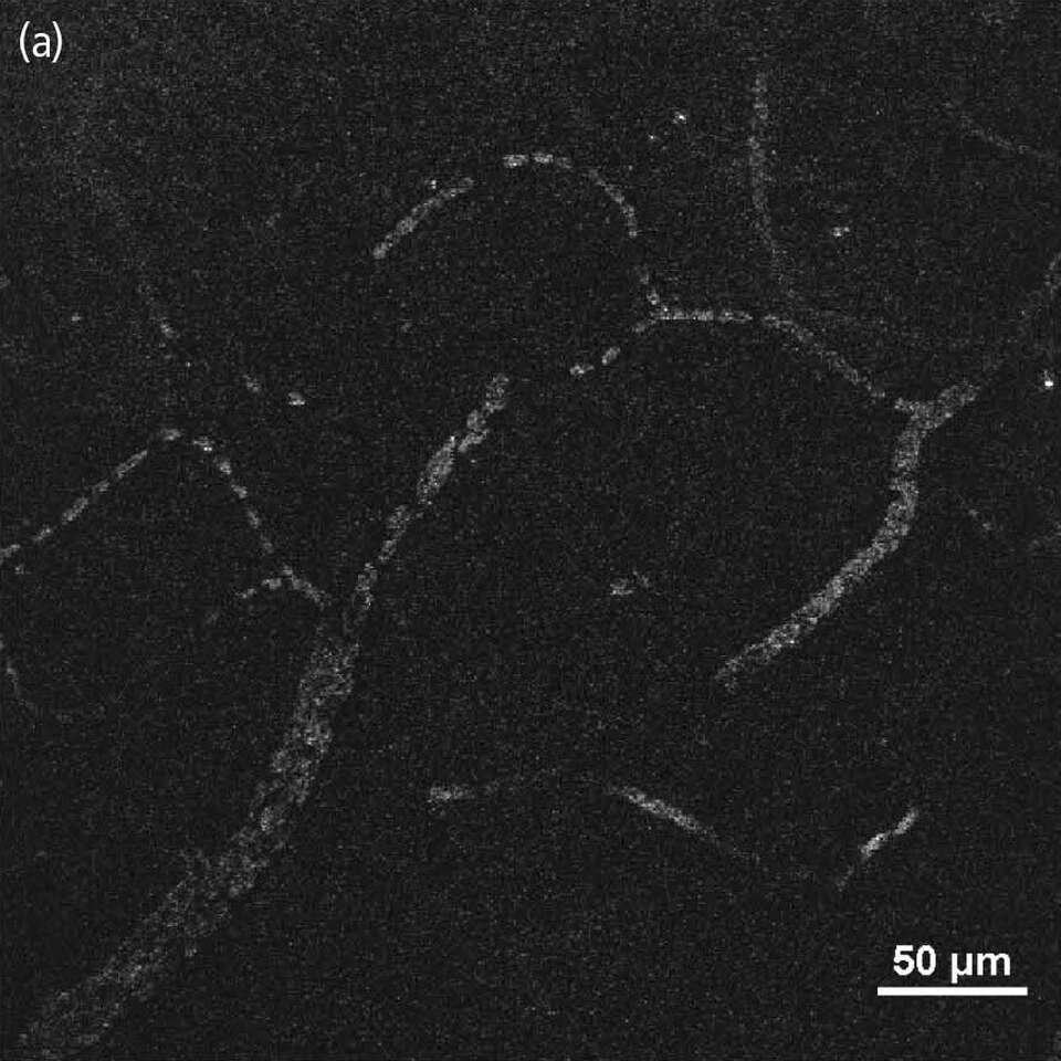 High-speed, label-free THG imaging of red blood cells using a ...