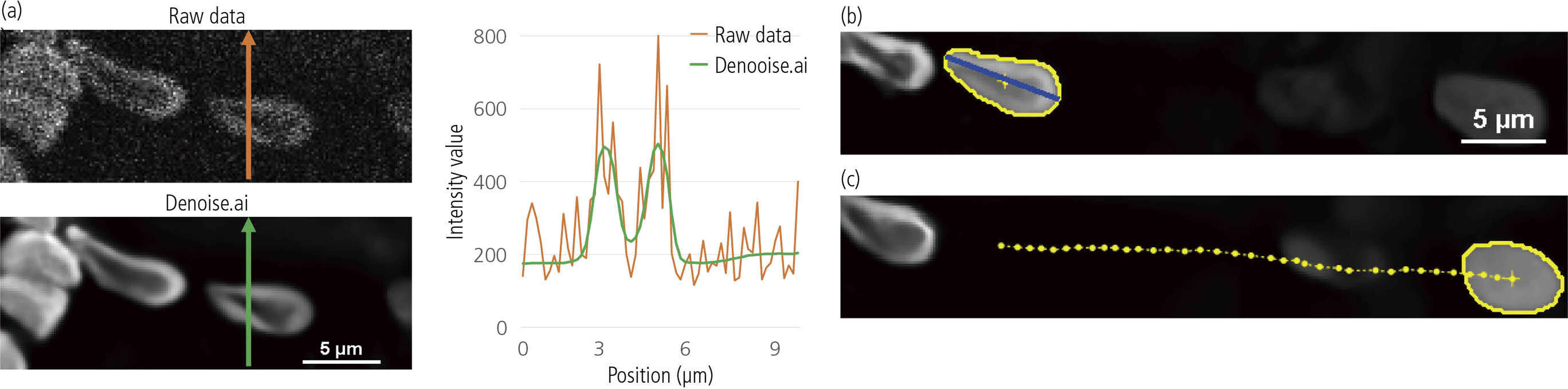 High-speed, label-free THG imaging of red blood cells using a ...