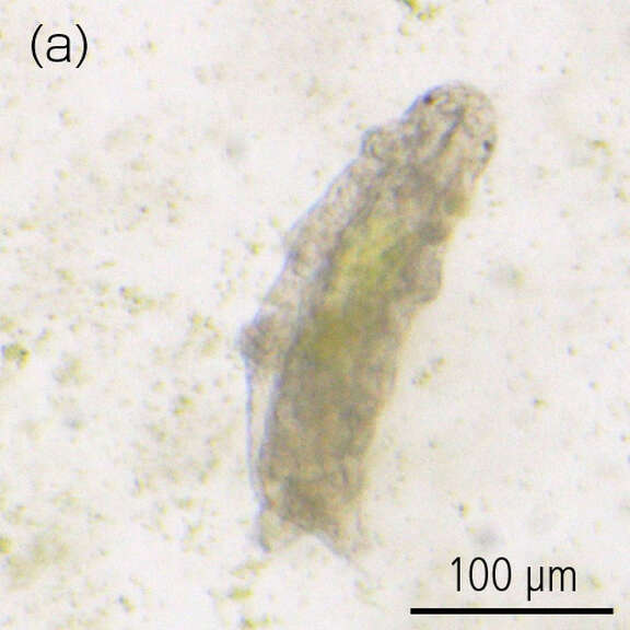 Water Bear Under Microscope