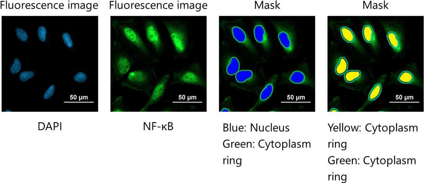 Analysis of nuclear translocation using AI-driven fully automated ...