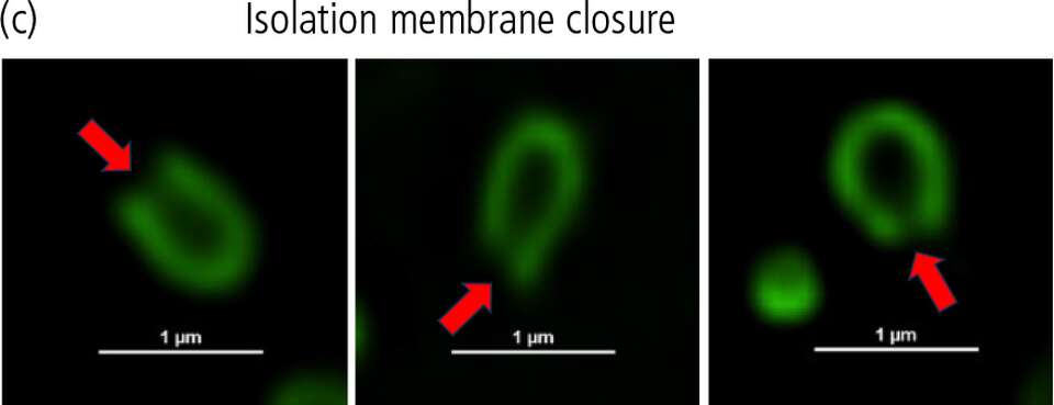 High-sensitivity confocal microscope detector NSPARC enables live ...