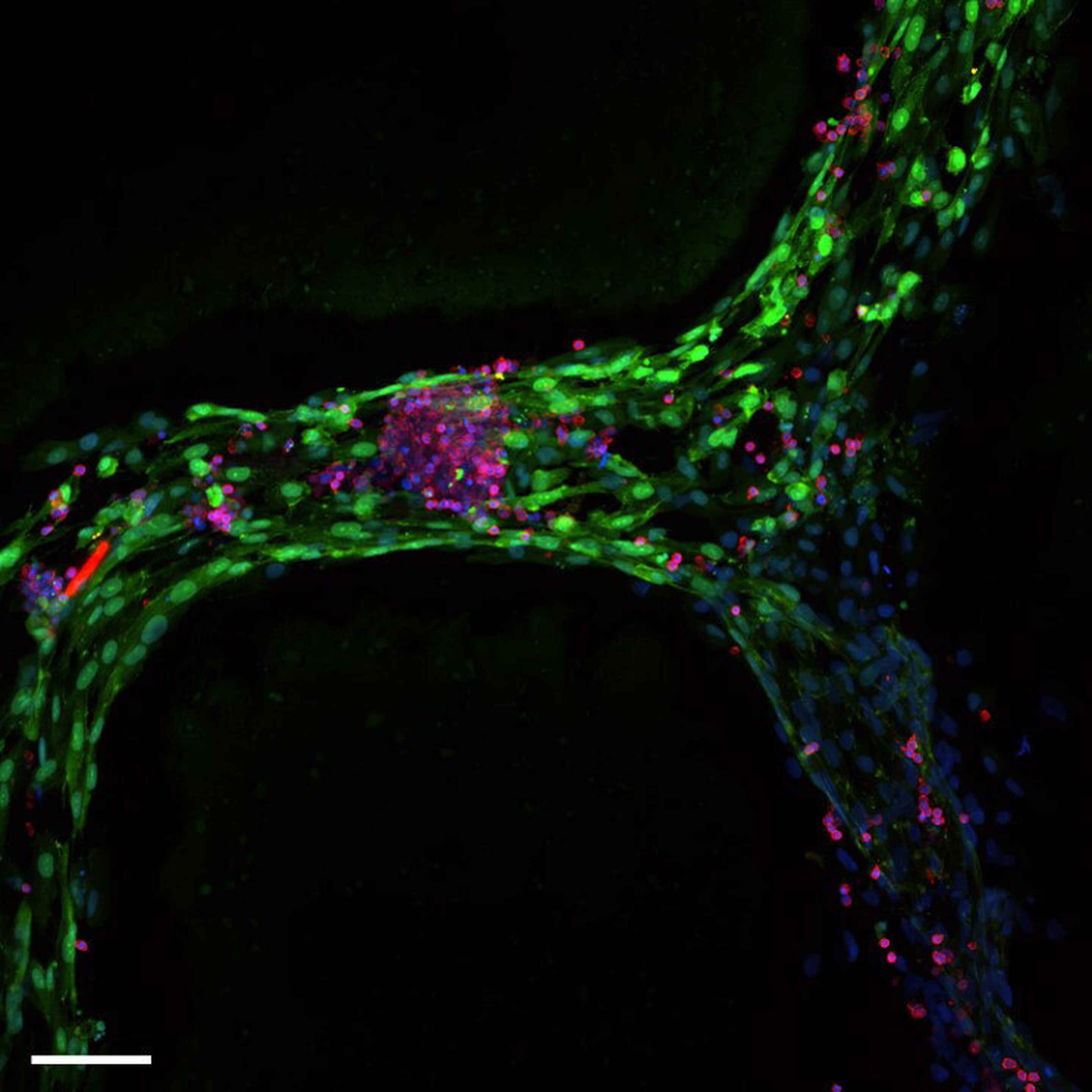 Confocal imaging of immune cells in a vasculature network using the ...