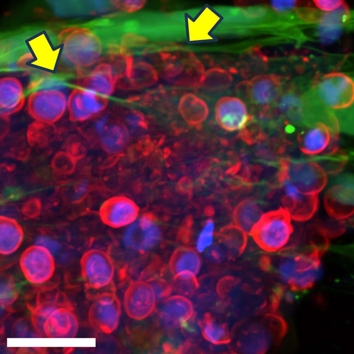 Confocal imaging of immune cells in a vasculature network using the ...