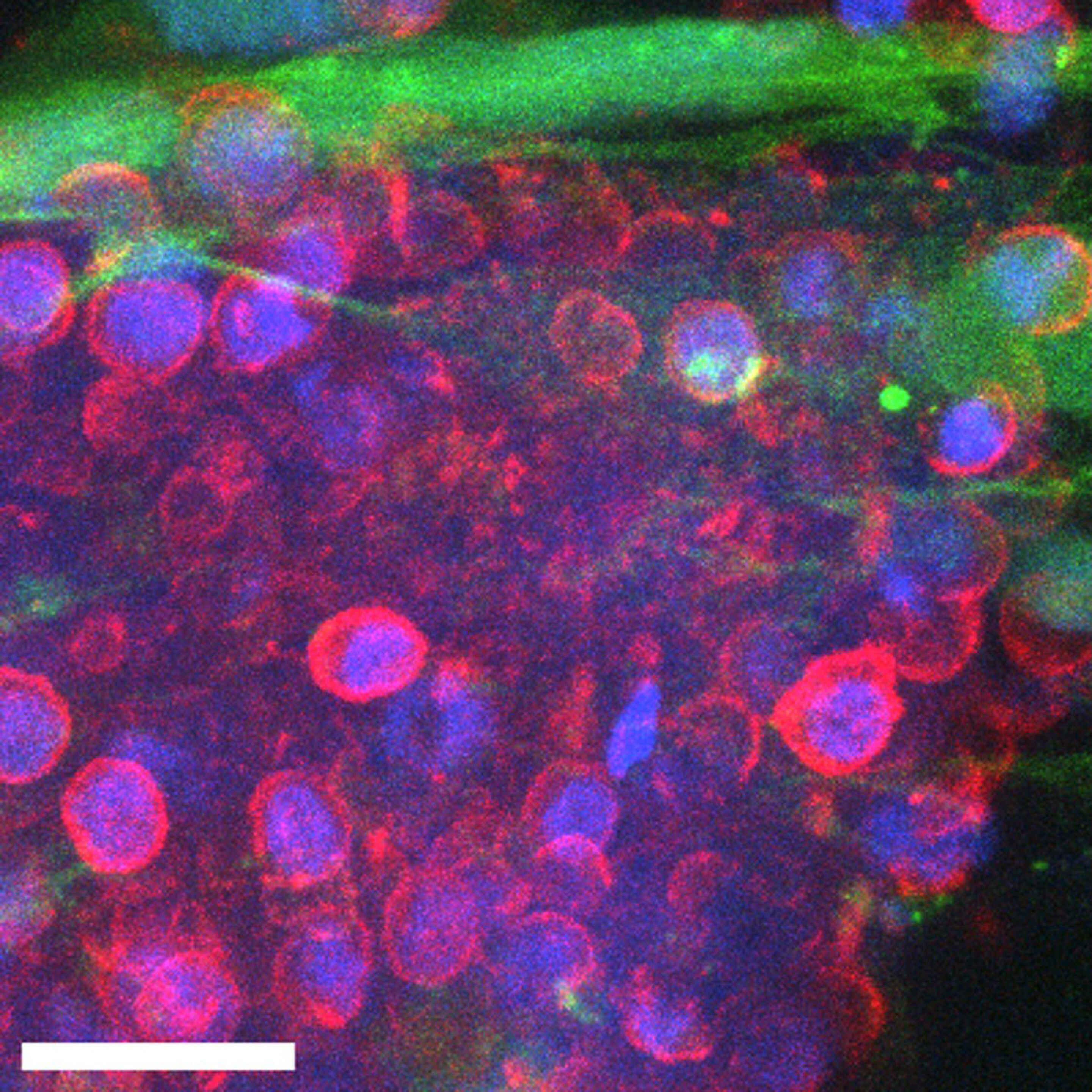 Confocal imaging of immune cells in a vasculature network using the ...