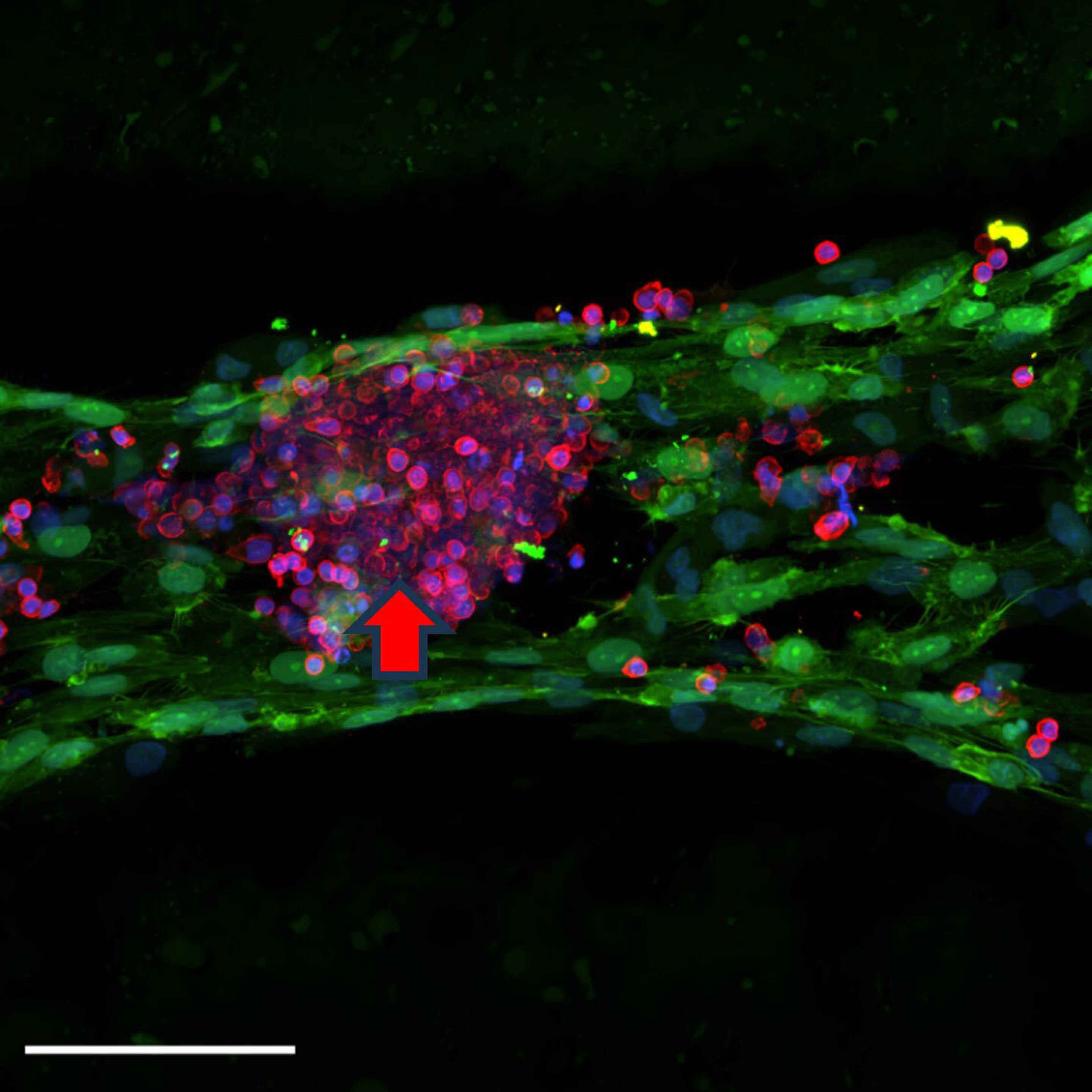 Confocal imaging of immune cells in a vasculature network using the ...