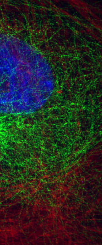 CSU-W1 SoRa | Yokogawa CSU Series | Confocal and Multiphoton ...