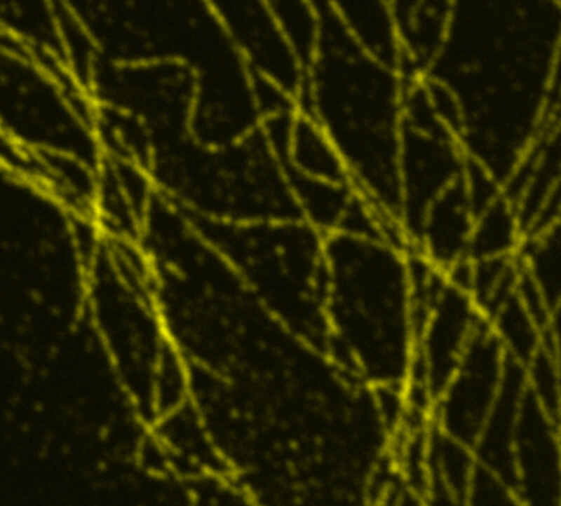 CSU-W1 SoRa | Yokogawa CSU Series | Confocal and Multiphoton ...