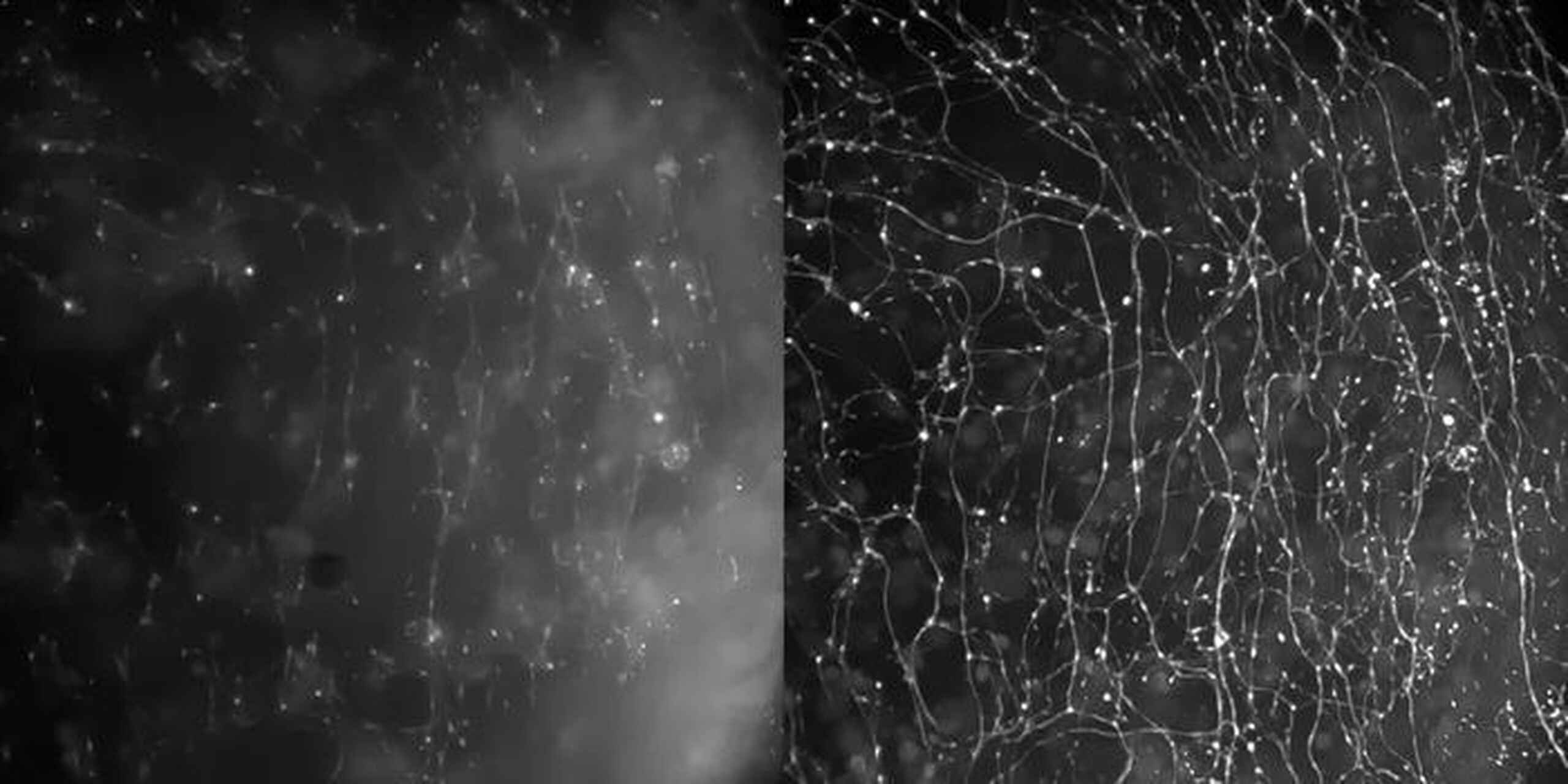 CSU-X1 | Yokogawa CSU Series | Confocal and Multiphoton Microscopes ...