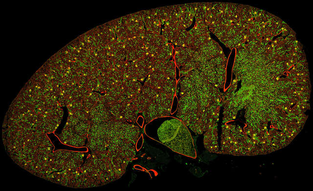 Crest X-Light V3 | CrestOptics X-Light Series | Confocal and ...