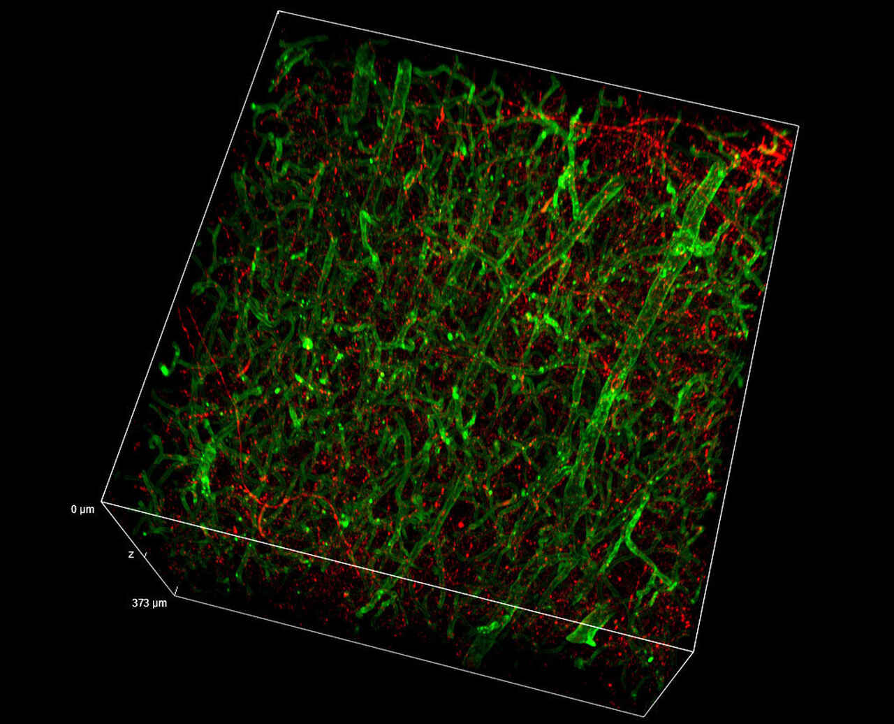 Crest X-Light V3 | CrestOptics X-Light Series | Confocal and ...