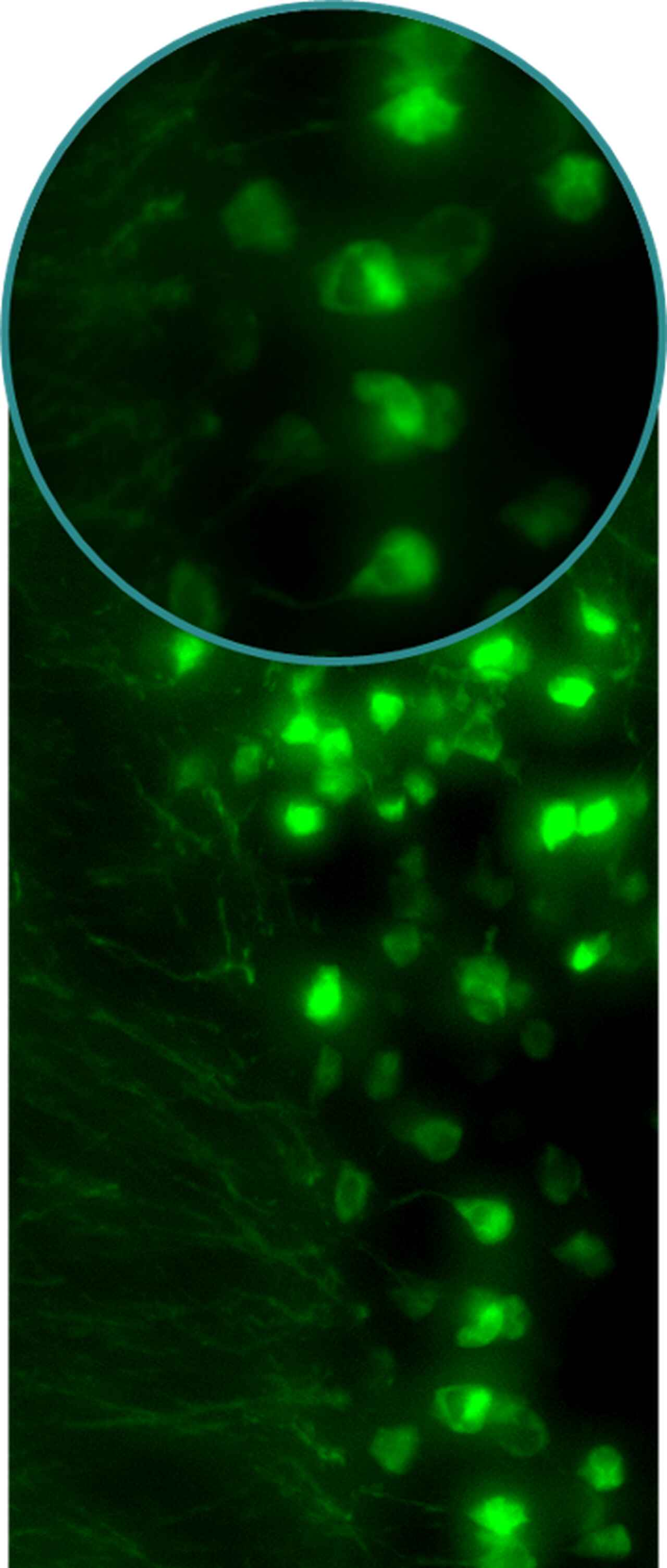 X-Light V3/DeepSIM | CrestOptics X-Light Series | Confocal and ...