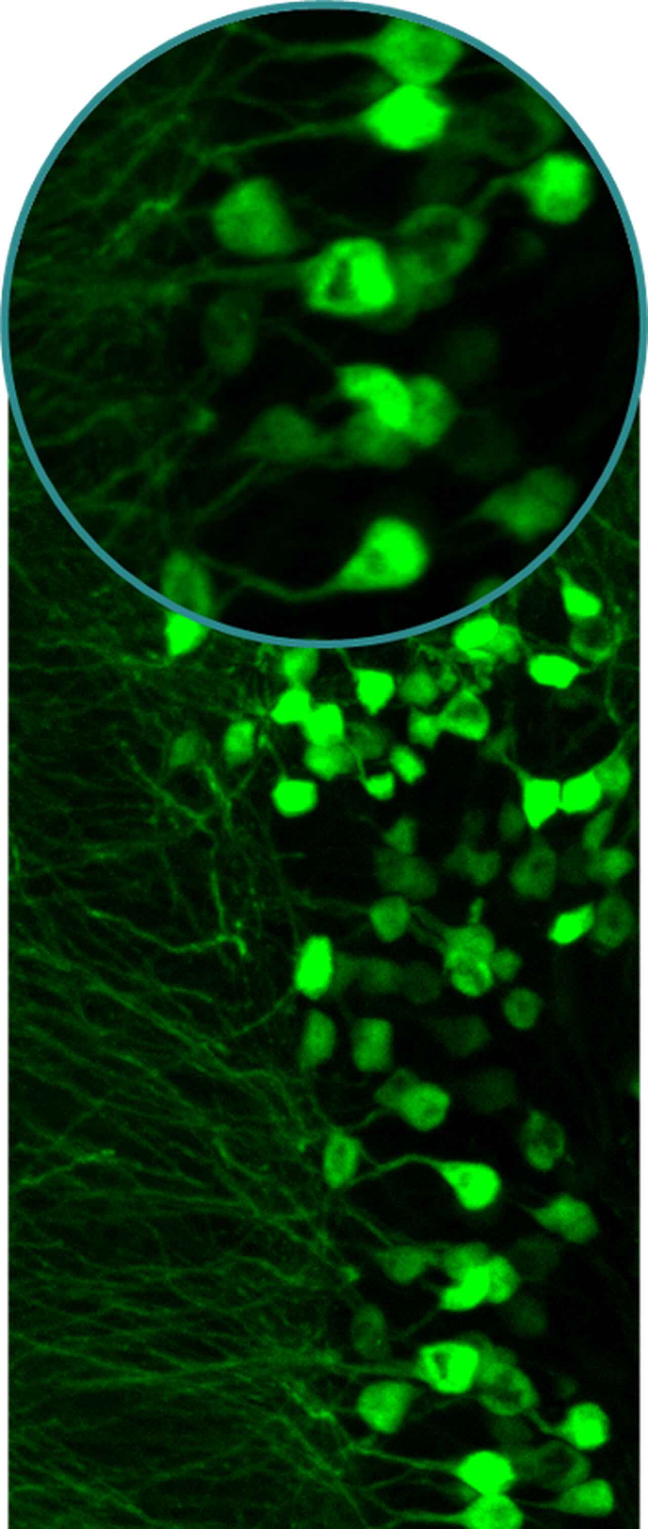 X-Light V3/DeepSIM | CrestOptics X-Light Series | Confocal and ...