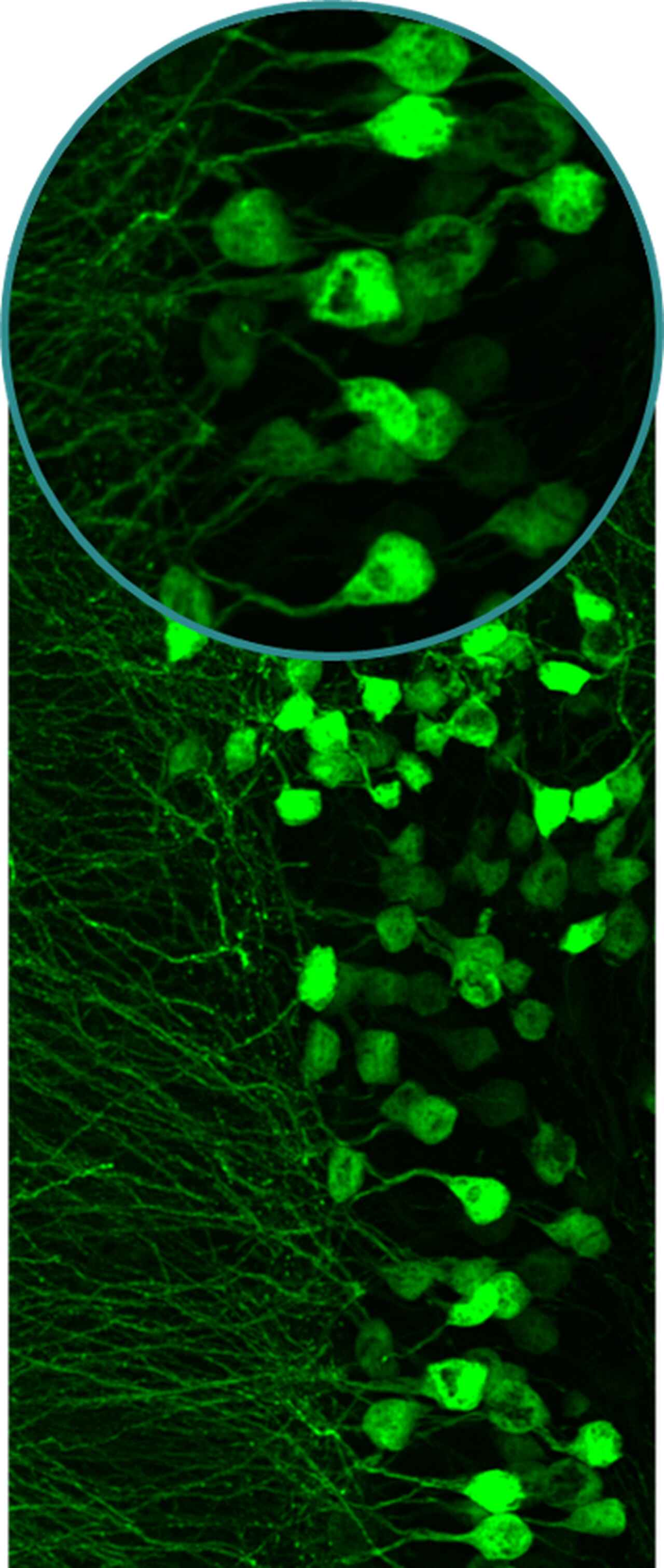X-Light V3/DeepSIM | CrestOptics X-Light Series | Confocal and ...