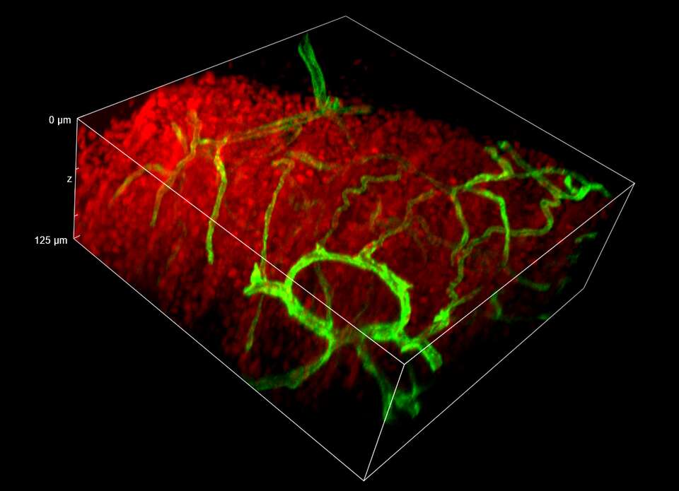 X-Light V3/DeepSIM | CrestOptics X-Light Series | Confocal and ...