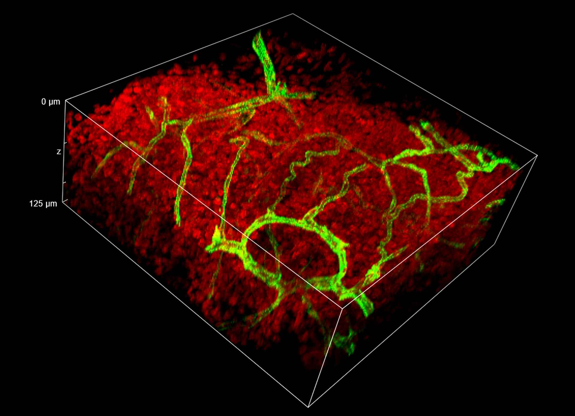 X-Light V3/DeepSIM | CrestOptics X-Light Series | Confocal and ...