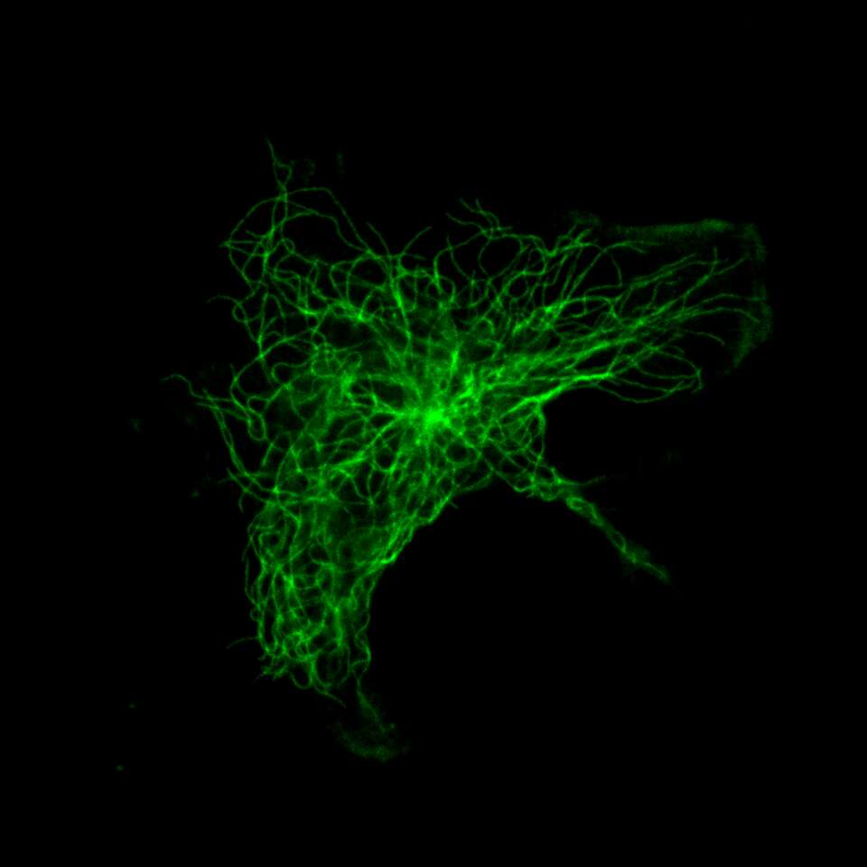 X-Light V3/DeepSIM | CrestOptics X-Light Series | Confocal and ...