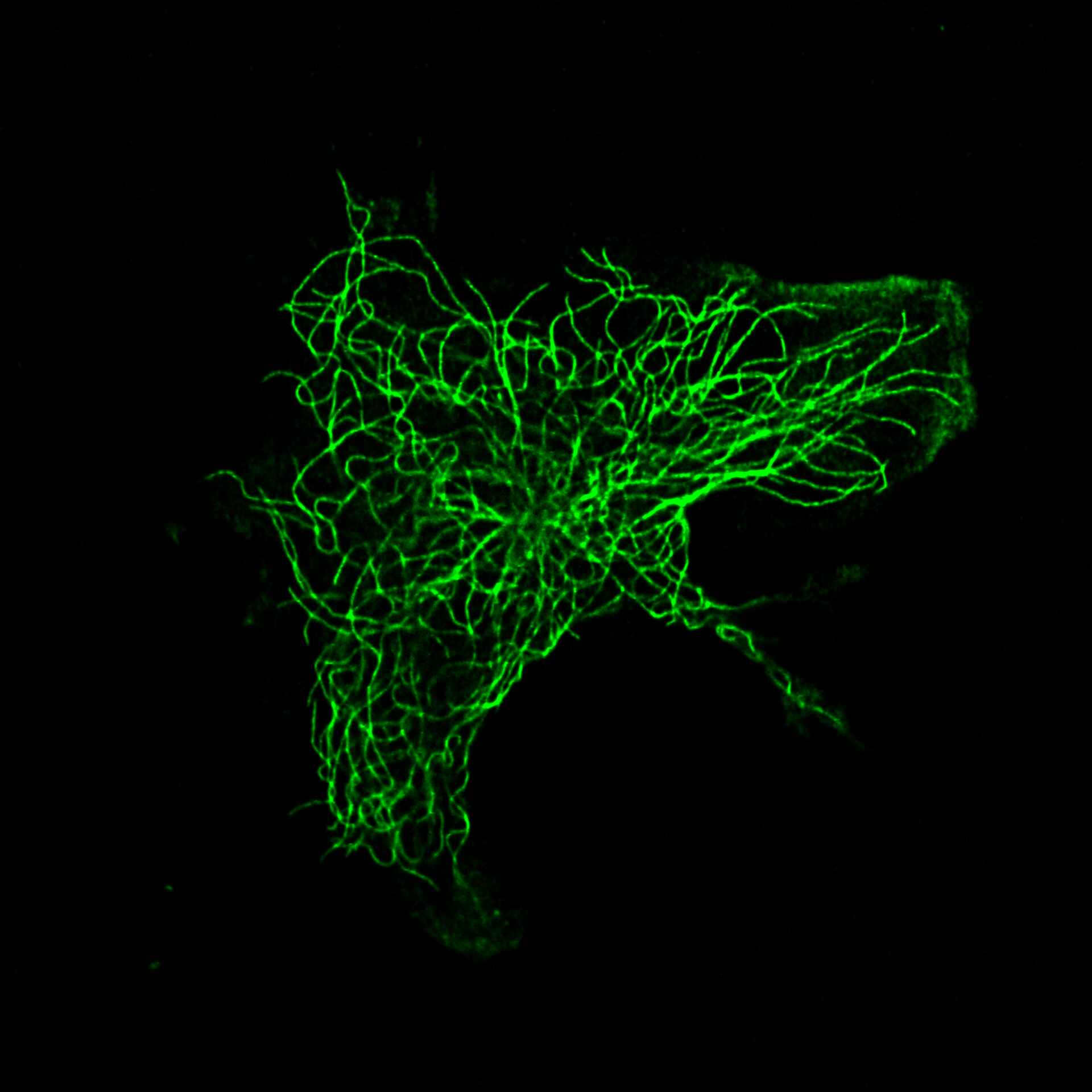 X-Light V3/DeepSIM | CrestOptics X-Light Series | Confocal and ...