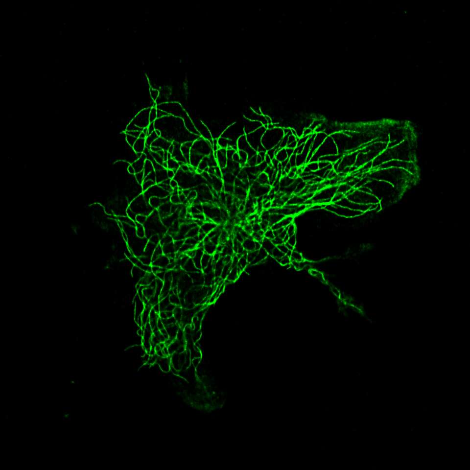 X-Light V3/DeepSIM | Crest X-Light Series | Confocal and Multiphoton ...