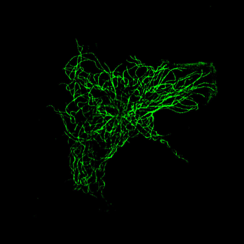 CrestOptics DeepSIM | Super-Resolution Microscopes | Microscope ...