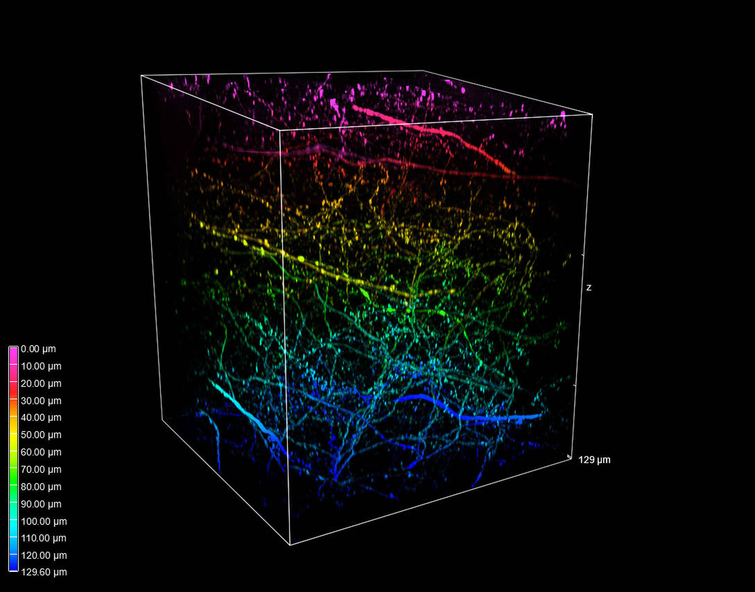 CrestOptics DeepSIM | Super-Resolution Microscopes | Microscope Products | Nikon Instruments Inc.