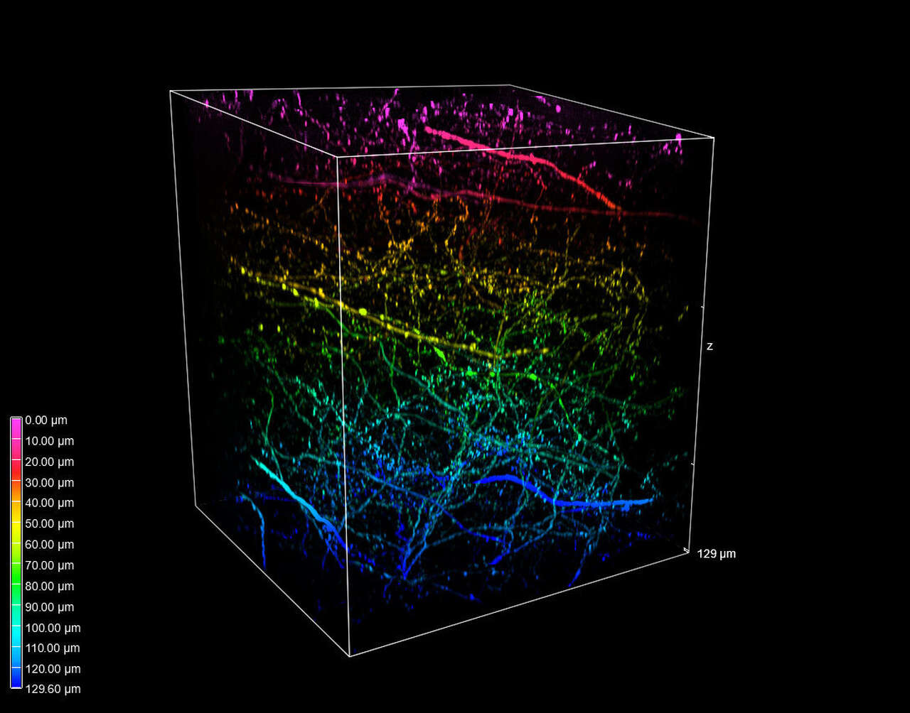 CrestOptics DeepSIM | Super-Resolution Microscopes | Microscope Products | Nikon Instruments Inc.