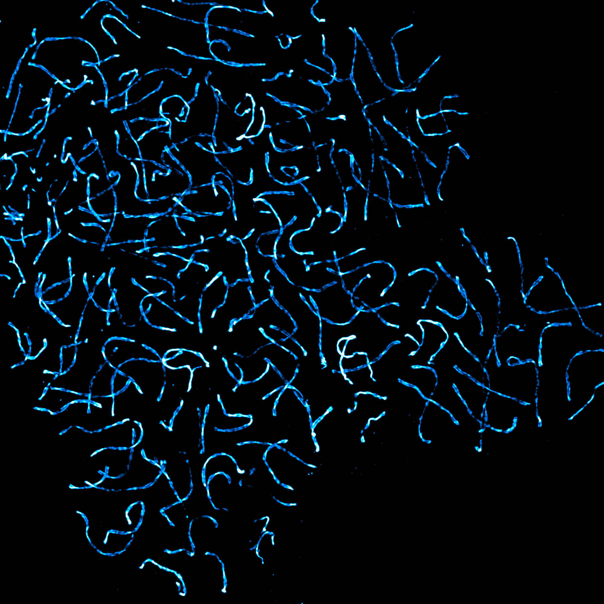 CrestOptics DeepSIM | Super-Resolution Microscopes | Microscope ...