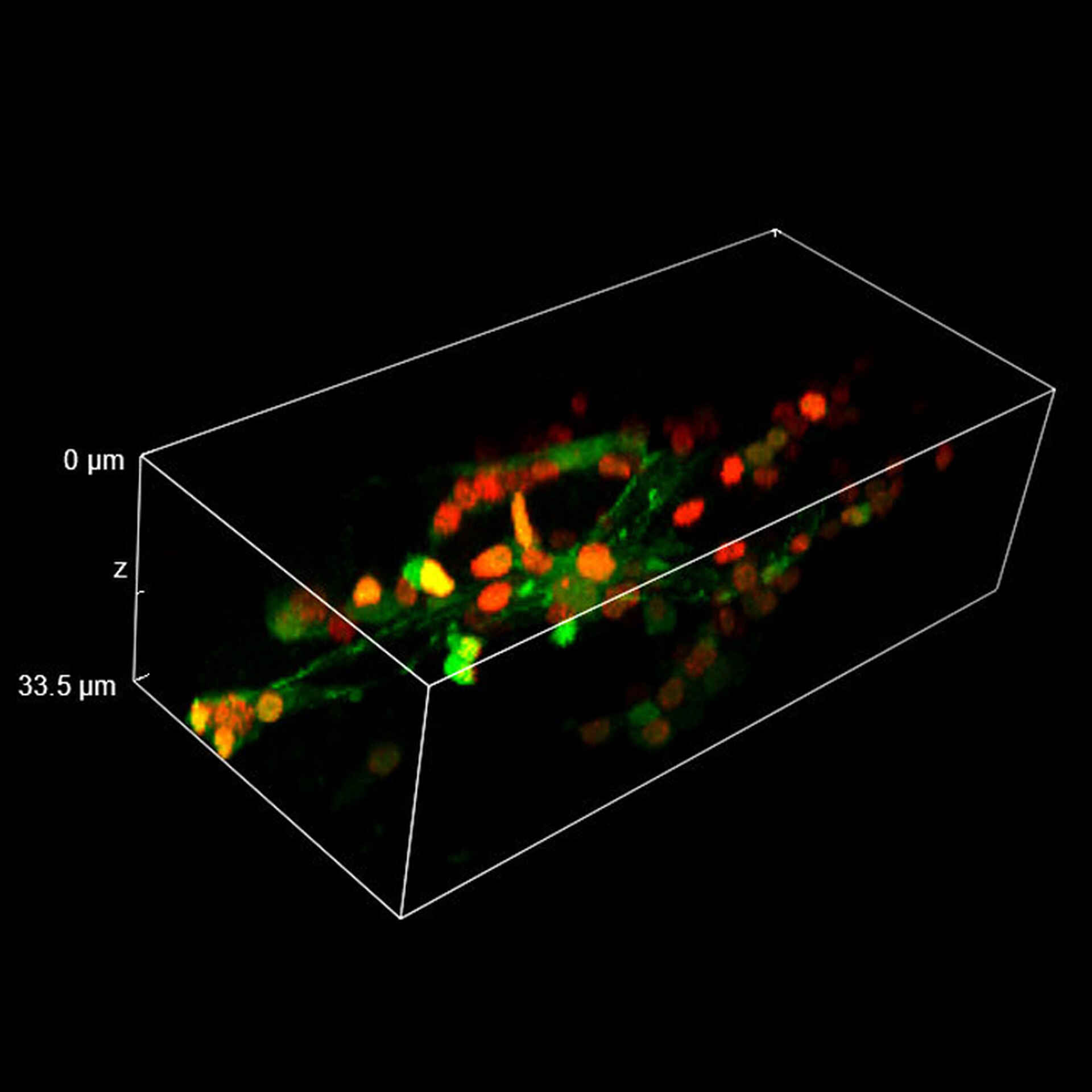 CrestOptics DeepSIM | Super-Resolution Microscopes | Microscope ...