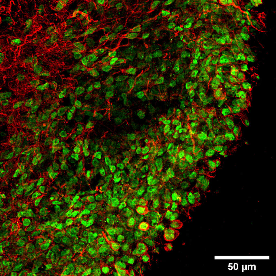 CrestOptics DeepSIM | Super-Resolution Microscopes | Microscope ...