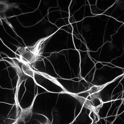 Crest X-Light V2 | Crest X-Light Series | Confocal and Multiphoton ...