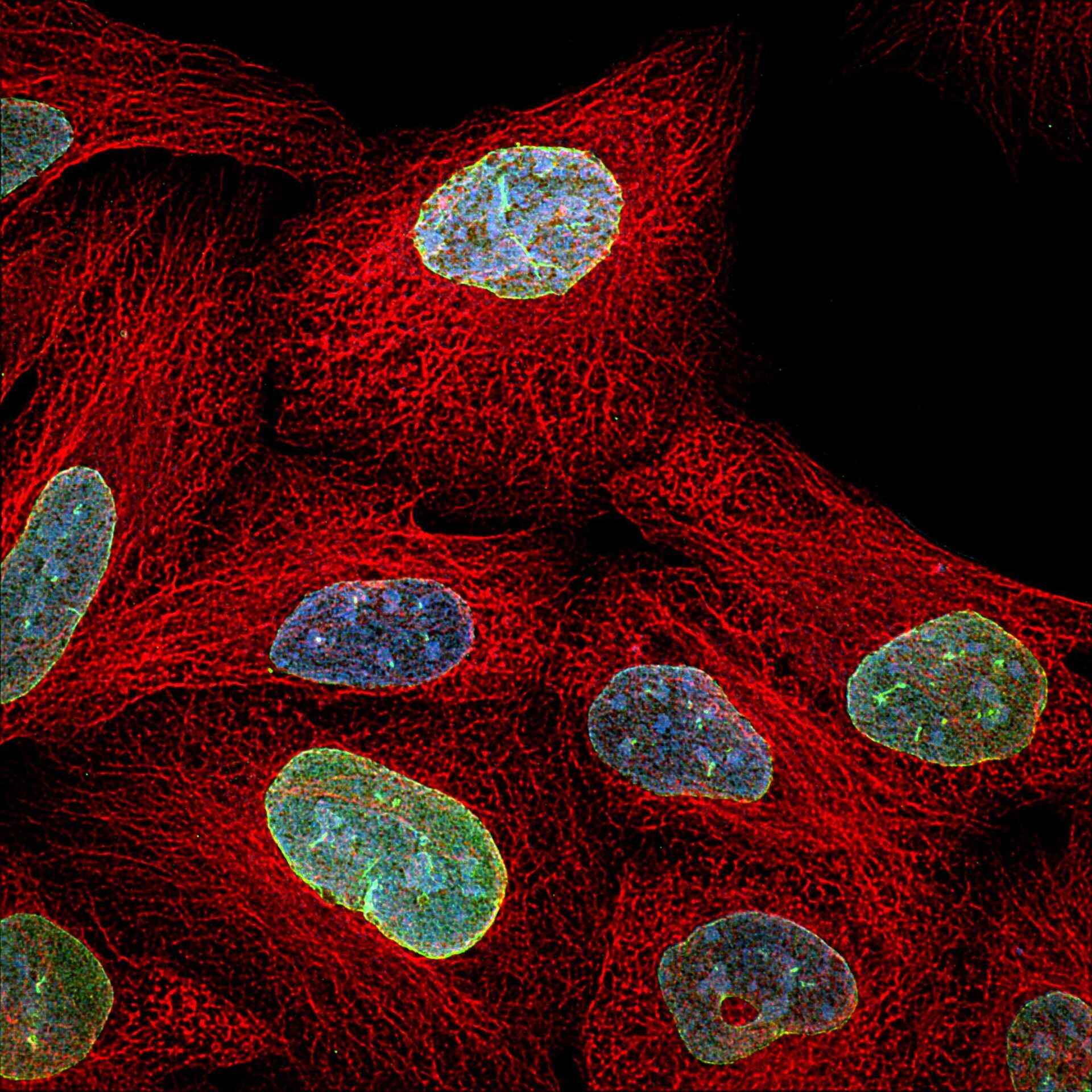 X-Light V3/DeepSIM | CrestOptics X-Light Series | Confocal and ...