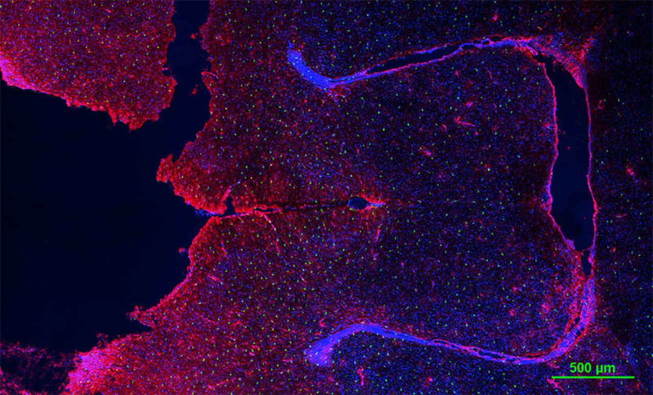 Crest X-Light V3 | Crest X-Light Series | Confocal Microscopes | Nikon ...