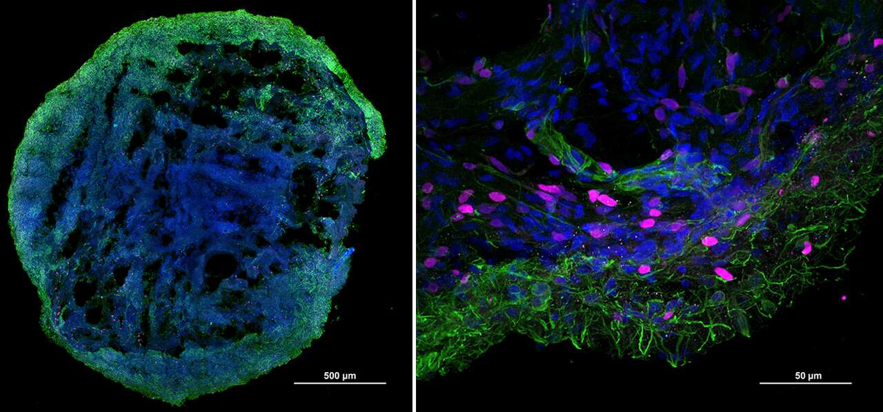 Crest X-Light V3 | Crest X-Light Series | Microscopios confocales y ...