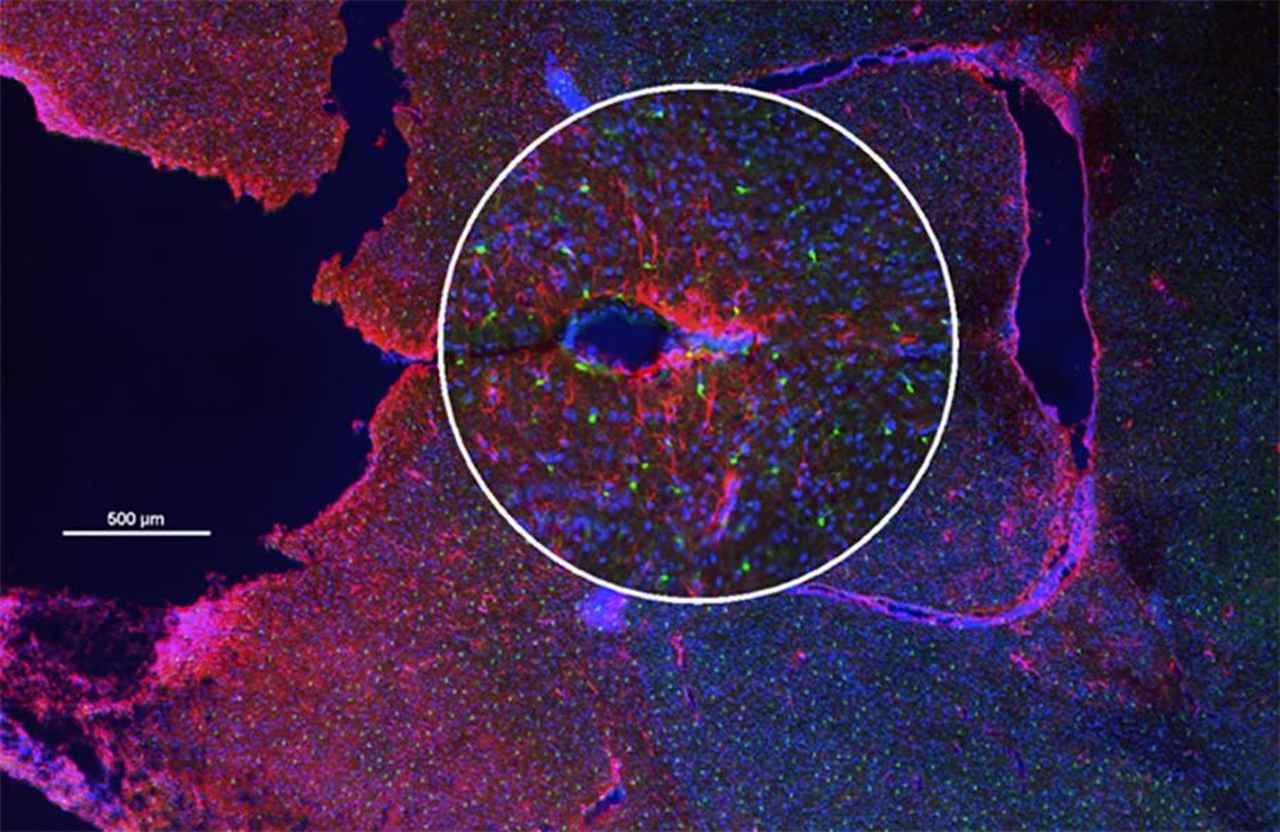 Crest X-Light V3 | Crest X-Light Series | Confocal Microscopes | Nikon ...