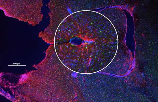 Crest X-Light V3 | Crest X-Light Series | Microscópios Confocais ...