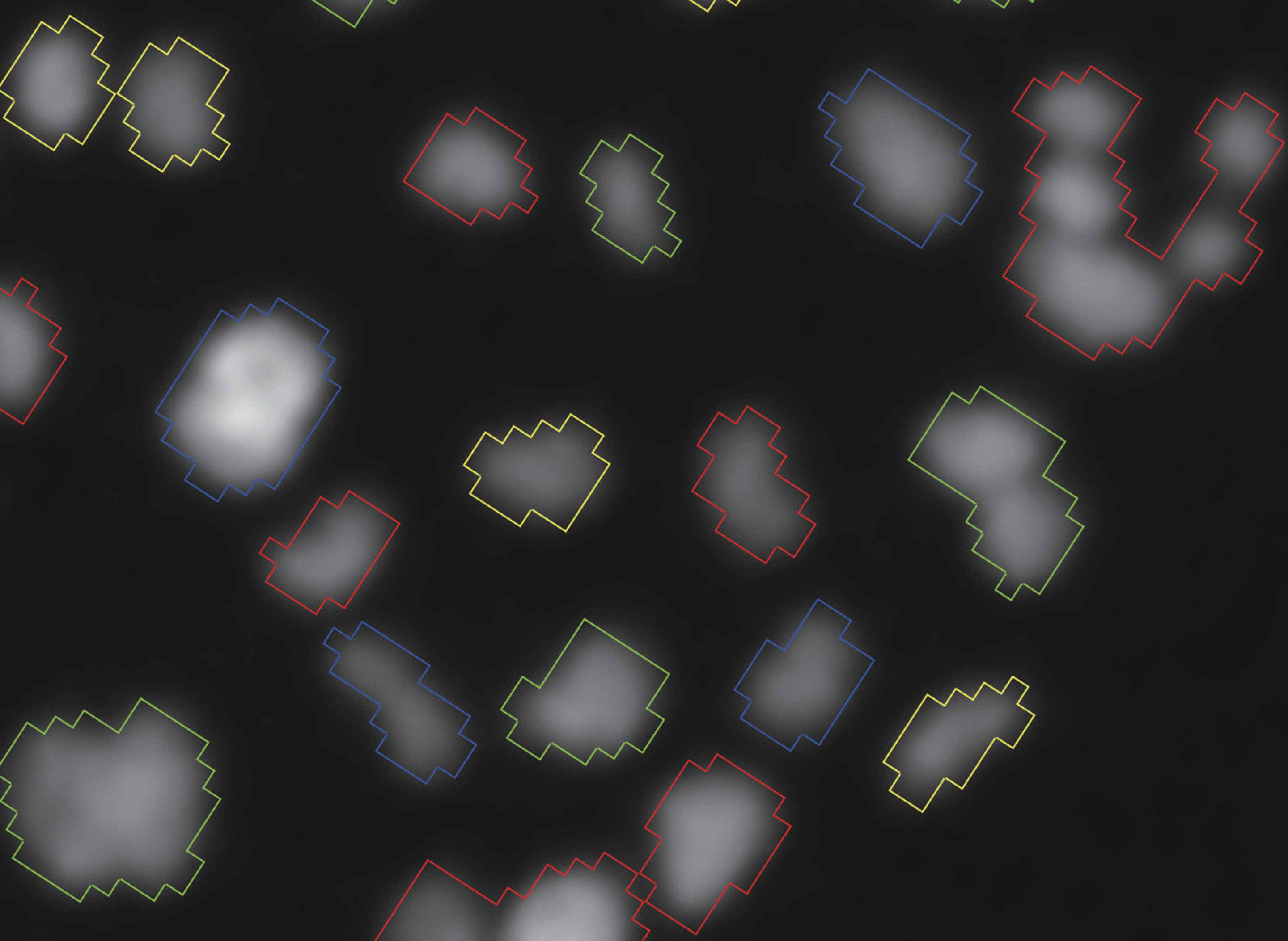 Digital Sight 50M | Cameras | Microscope Products | Nikon Instruments Inc.