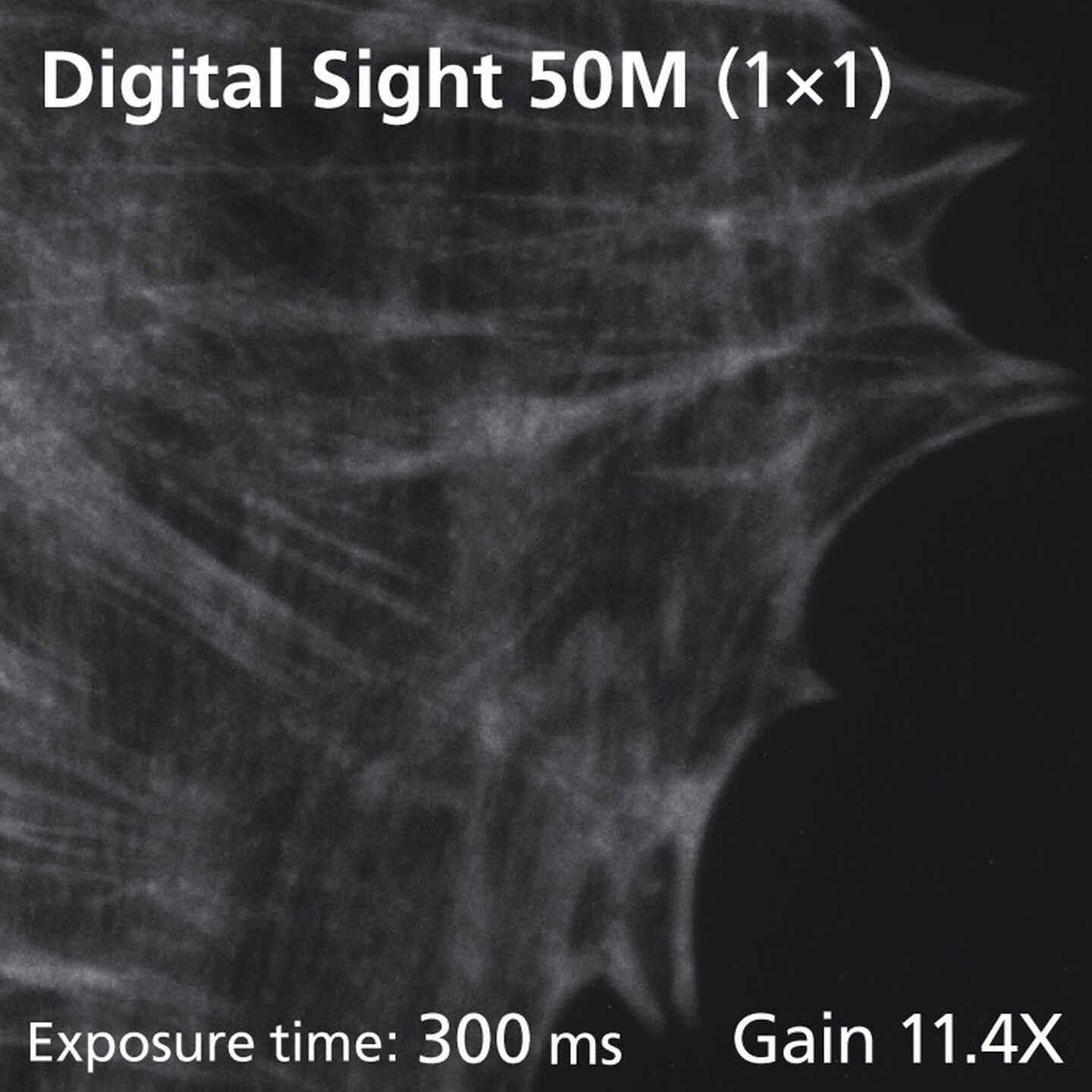 Digital Sight 50M | Cameras | Microscope Products | Nikon Instruments Inc.