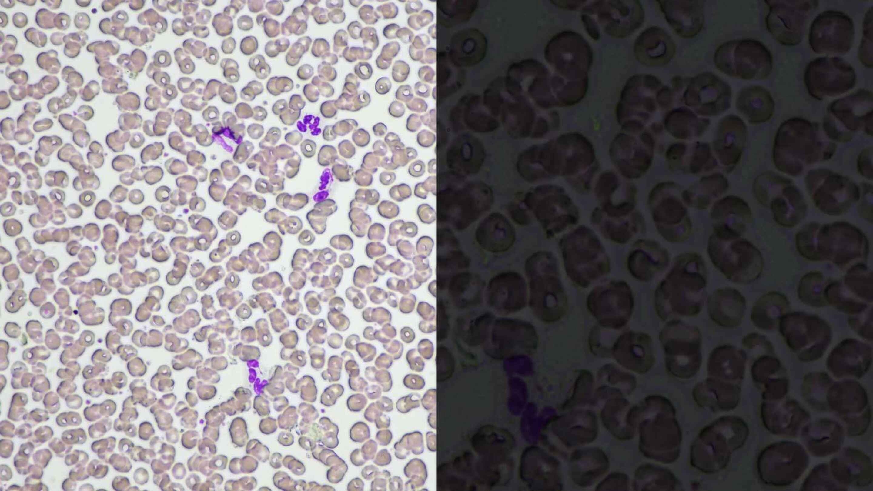 ECLIPSE Ci-L plus | Upright Microscopes | Microscope Products | Nikon Corporation Healthcare ...