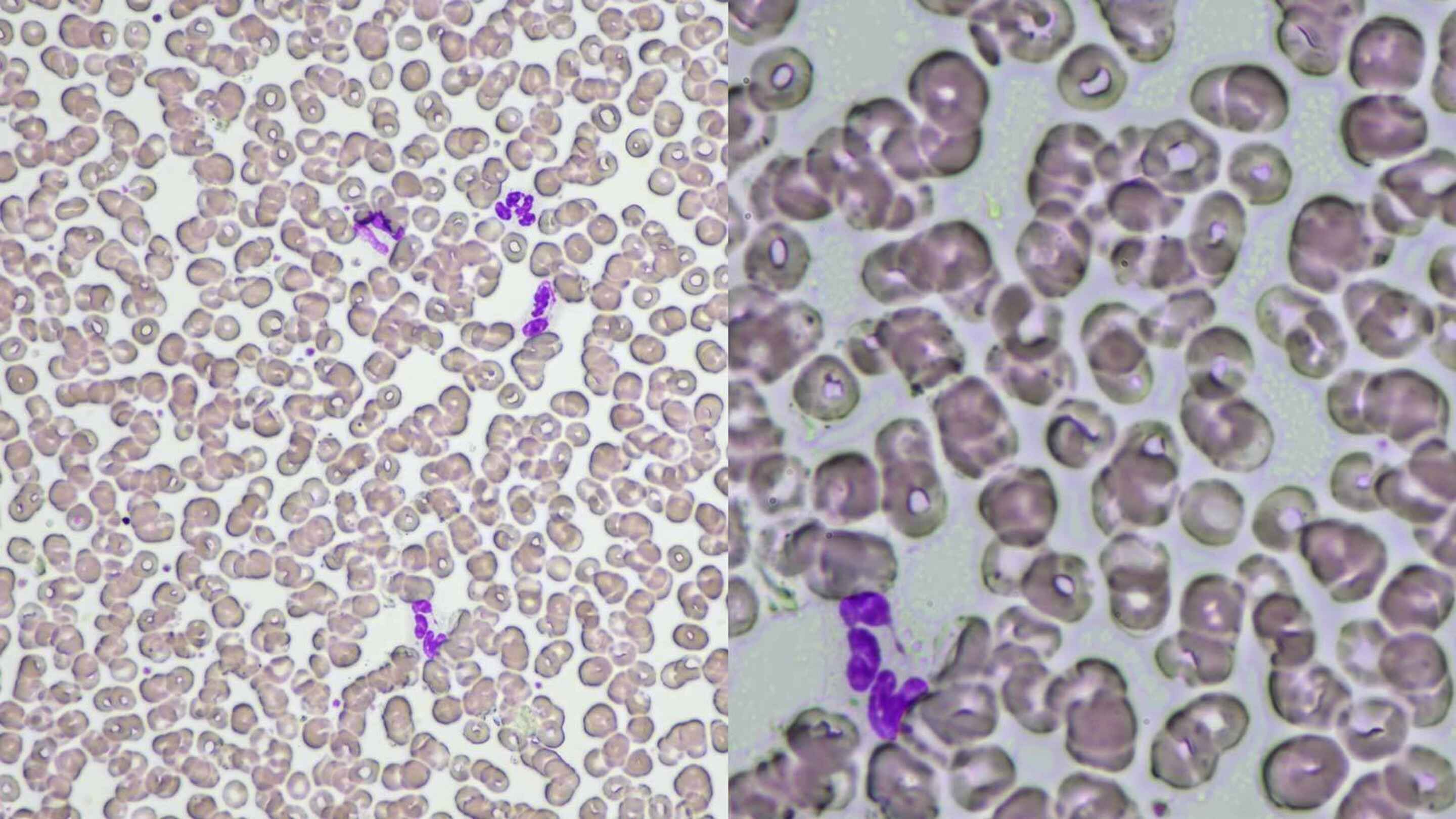 ECLIPSE Ci-L plus | Upright Microscopes | Microscope Products | Nikon ...