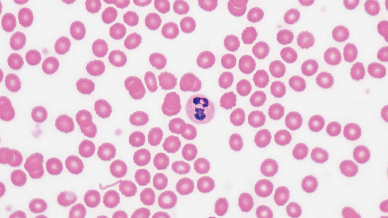 ECLIPSE Ei | Upright Microscopes | Microscope Products | Nikon Europe B.V.