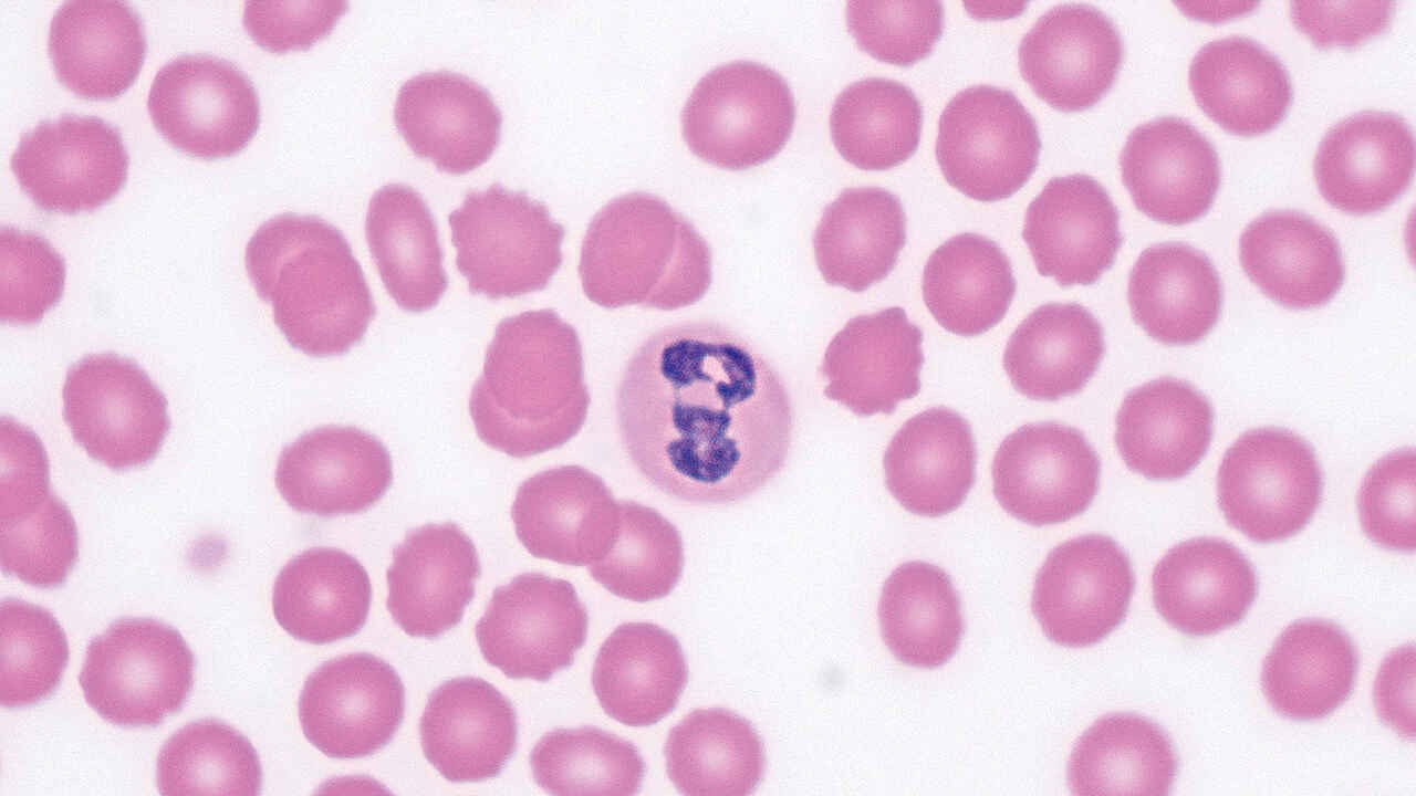 ECLIPSE Ei | Upright Microscopes | Microscope Products | Nikon ...