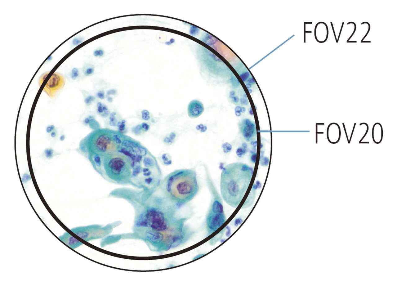 ECLIPSE Si | Upright Microscopes | Microscope Products | Nikon ...