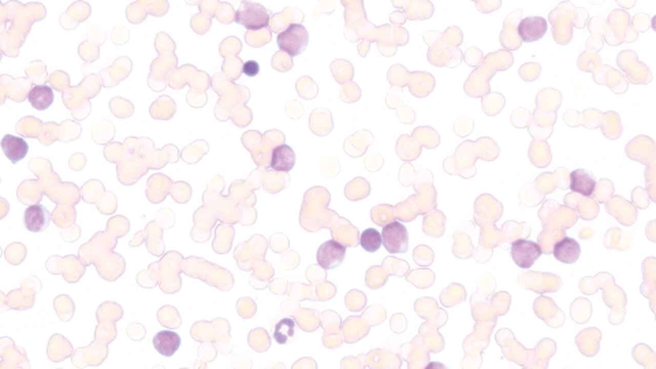 ECLIPSE Si | Upright Microscopes | Microscope Products | Nikon ...