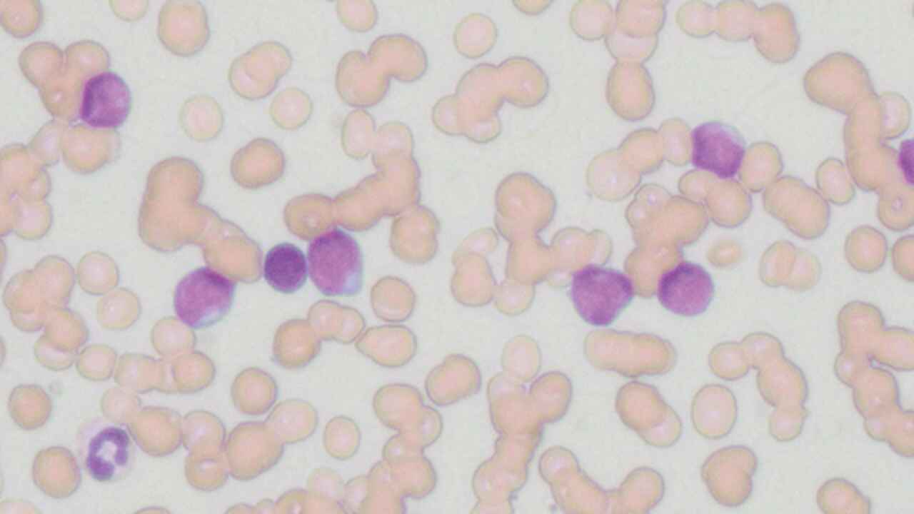 ECLIPSE Si | Upright Microscopes | Microscope Products | Nikon ...