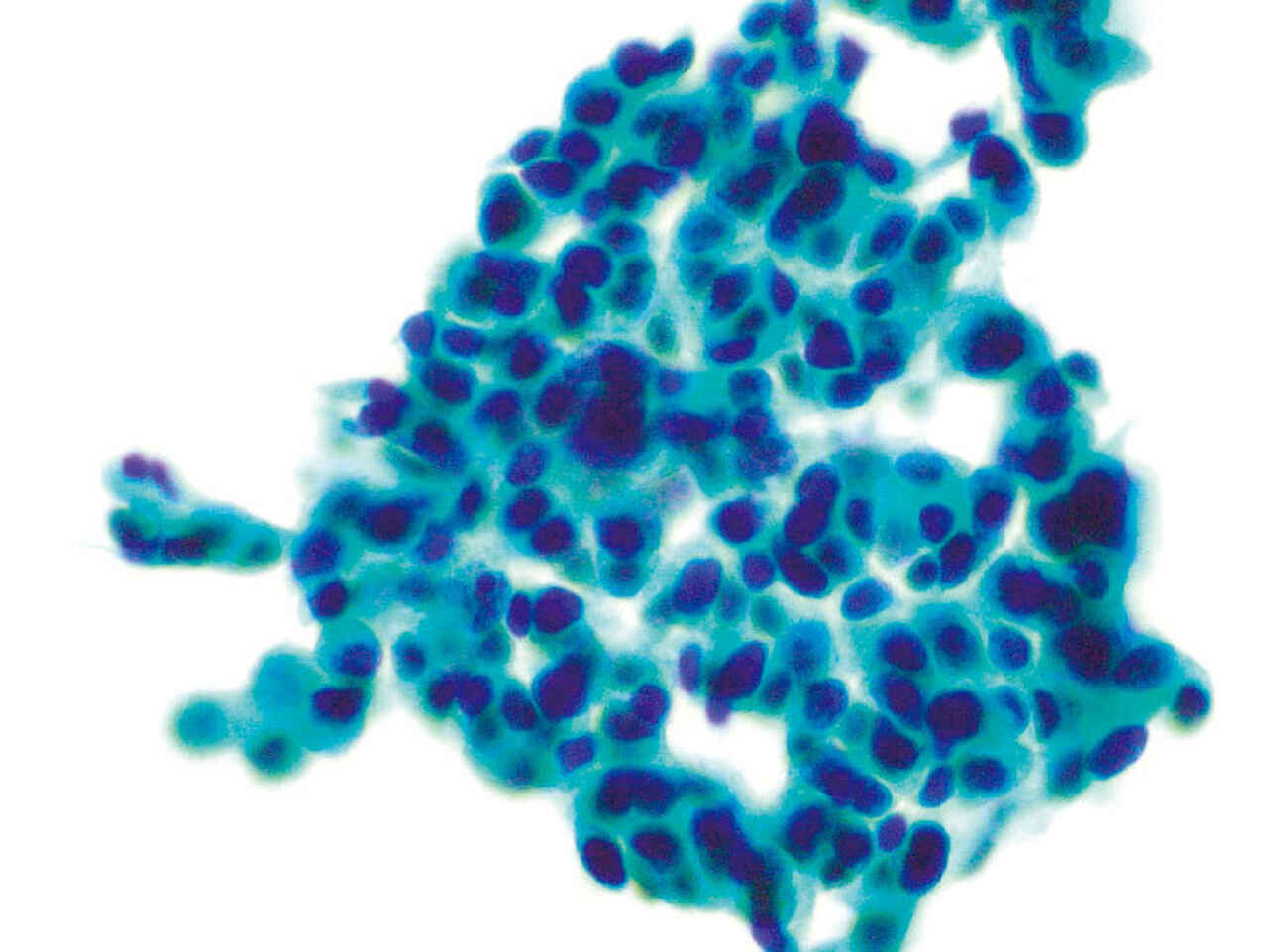 ECLIPSE Si | Upright Microscopes | Microscope Products | Nikon ...