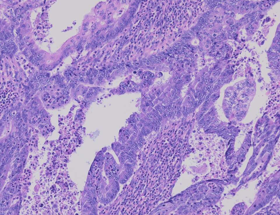 ECLIPSE Ui | Digital Microscopes | Microscope Products | Nikon ...