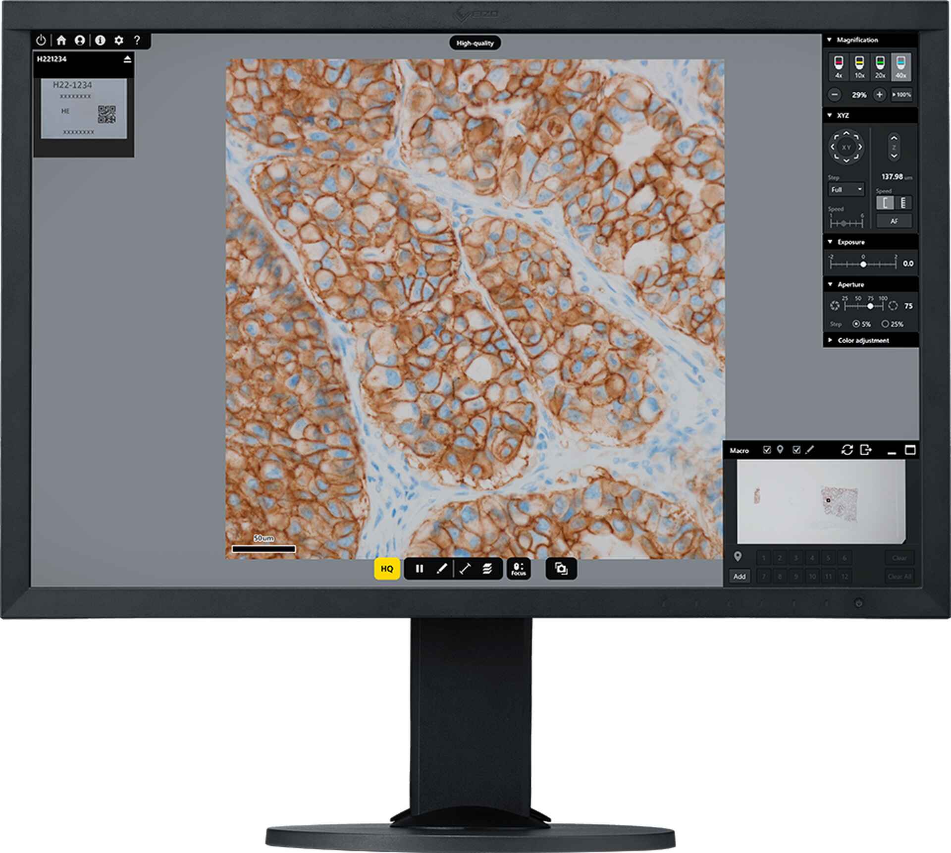 ECLIPSE Ui | Digital Microscopes | Microscope Products | Nikon ...